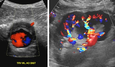Search results | BHCC Moodle