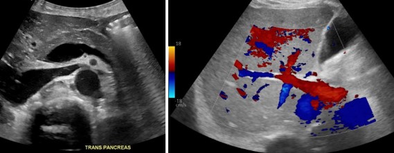 2025FA SON-113-01 | BHCC Moodle
